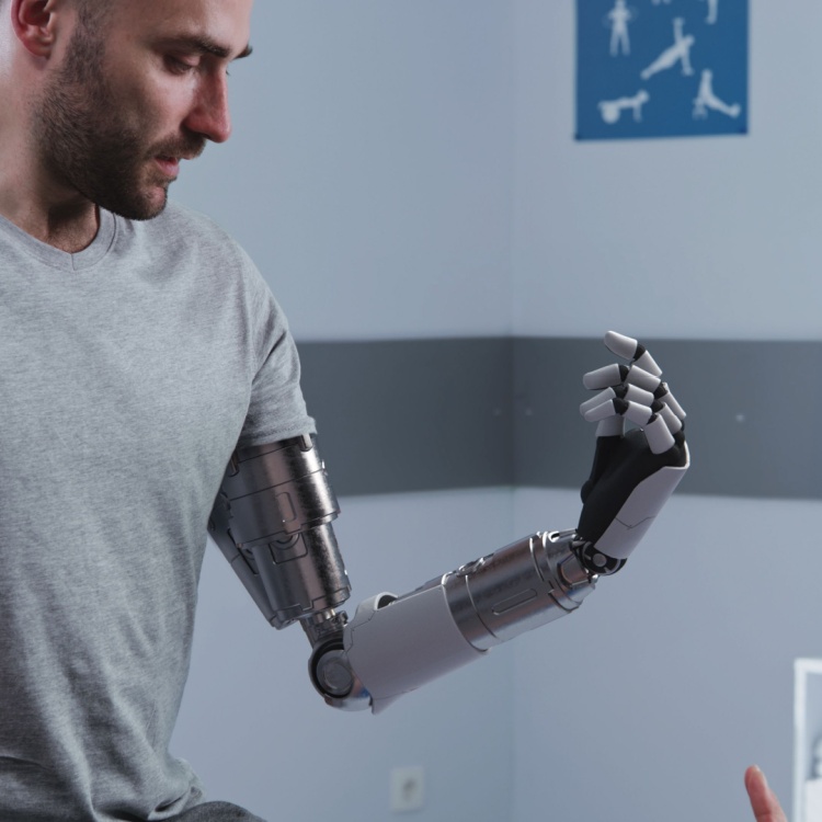 The Bionic Arm of the Future | IMI